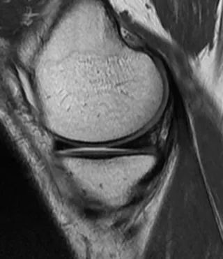 Suggested Collection｜Ultra-detailed MRI anatomy and diagnosis of ...